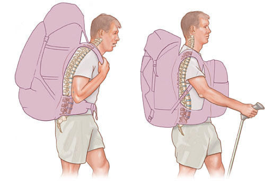 5 tips to help you hike without pain | Physionorth