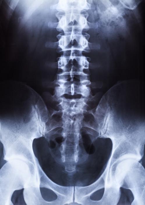 Are diagnostic scans necessary in diagnosing back pain? | Physionorth