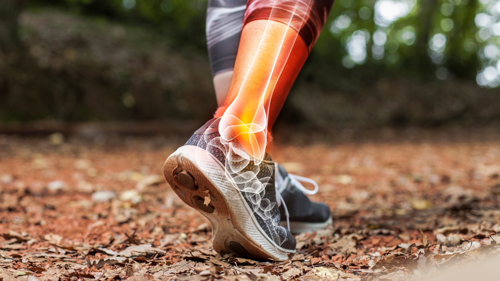 Commonly missed signs of injury and physio's role | Physionorth